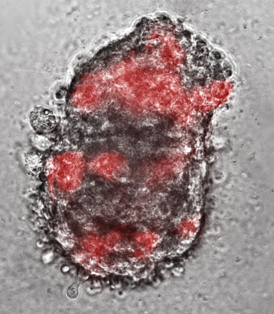 2017 Krush, Morgan – CaNCURE